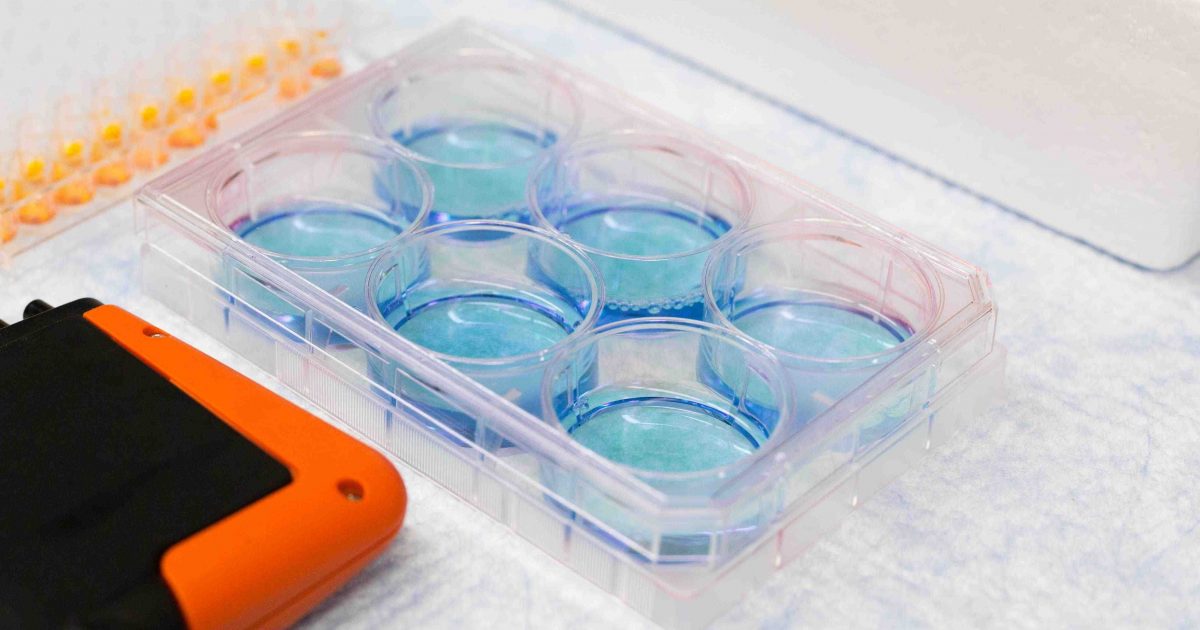 Qué Es El Reto Microbiano Contyquim
